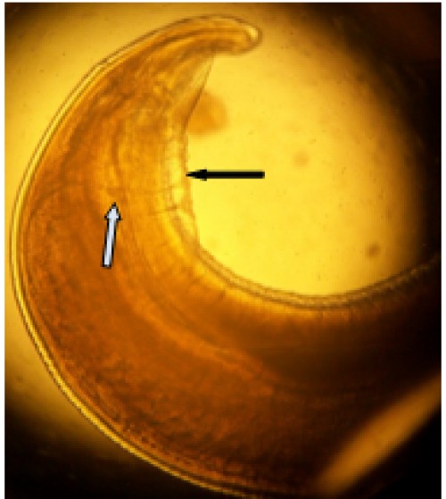 Pathological observation of incidental Spirocerca lupi infection with ...